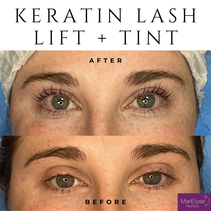 Keratin Lash Lift & Tint | Enhance Your Natural Lashes in St. Louis